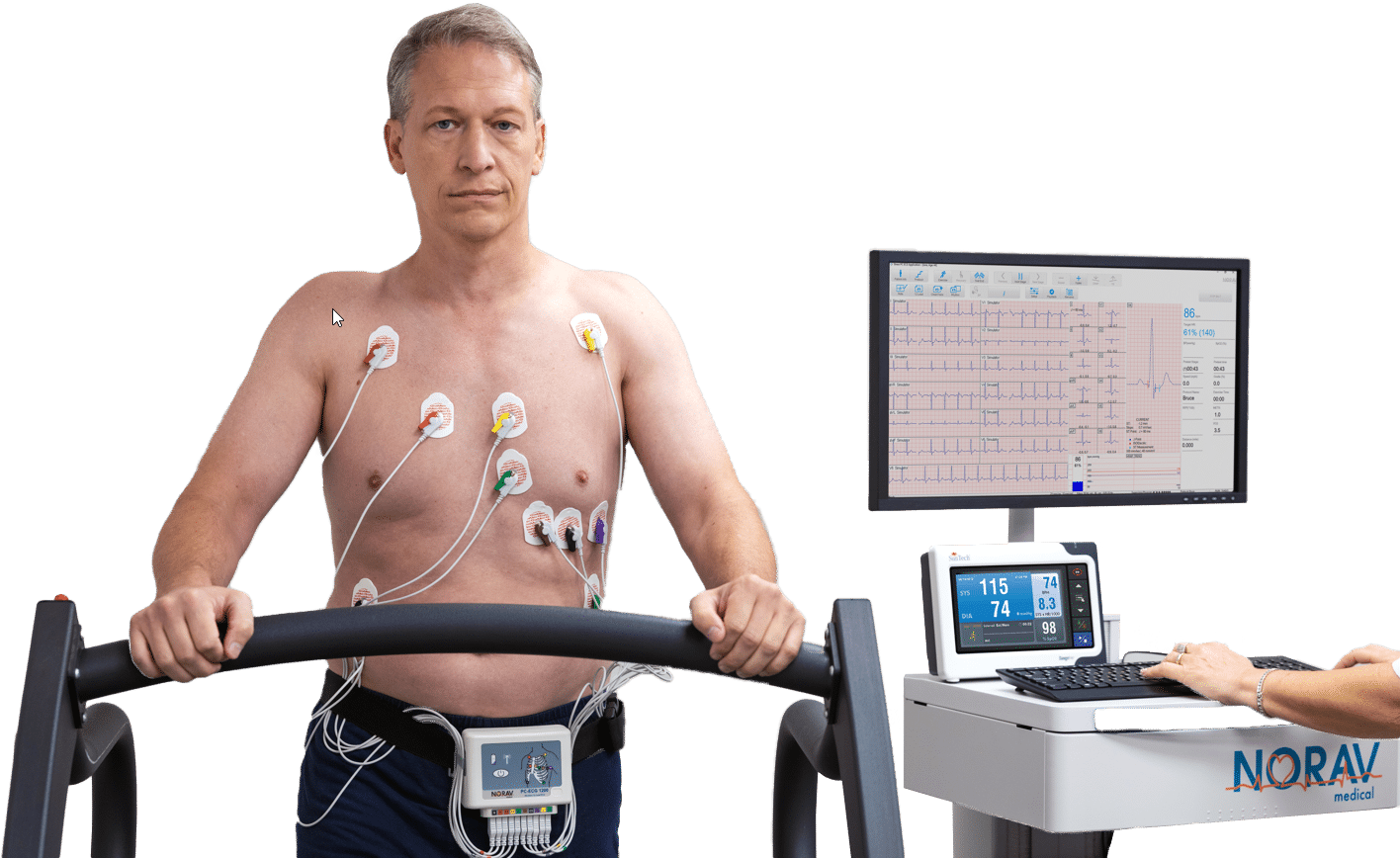 360° Norav ECG Excellence