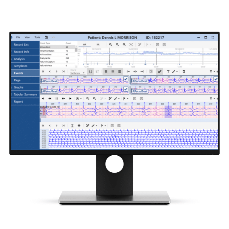 ECG Holter Monitoring System - Norav Medical