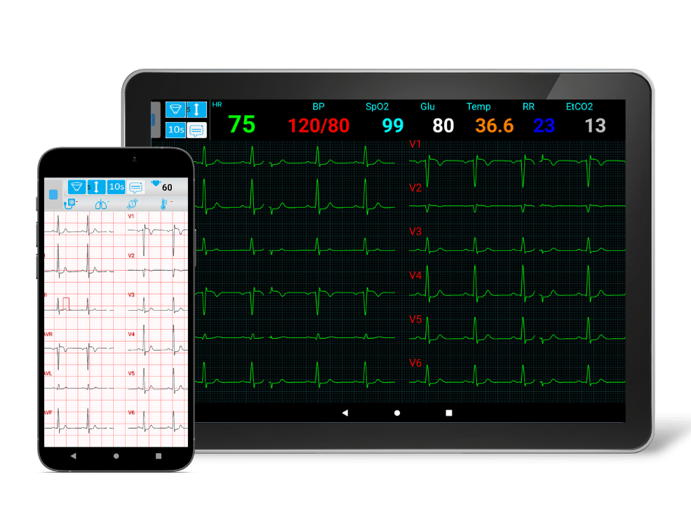 360° Norav ECG Excellence