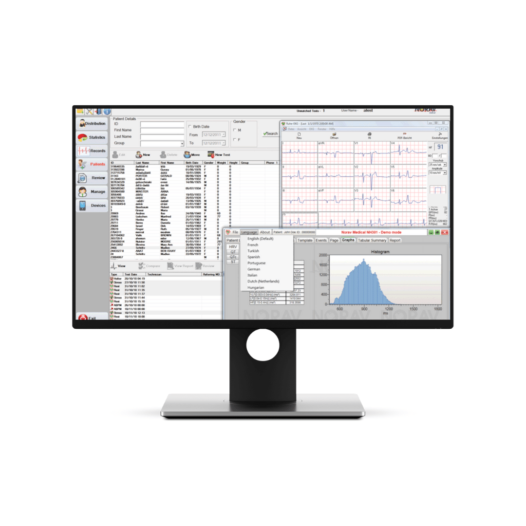 NEMS-Q - ECG Management System - Norav Medical