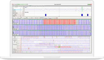 Holter ECG | Ultimate holter ecg monitor - Norav Medical