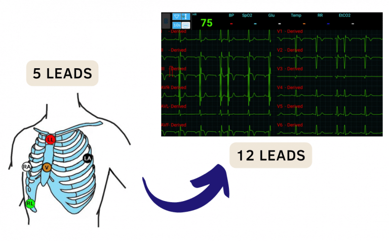 Resting ECG | 2024 Devices - Norav Medical