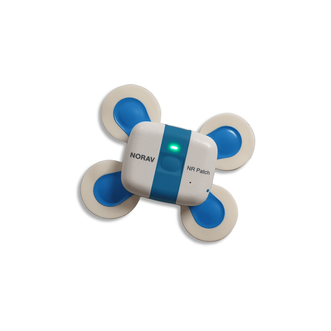 Norav Unveils the NR-314P Holter Device: Where Innovation Meets ...