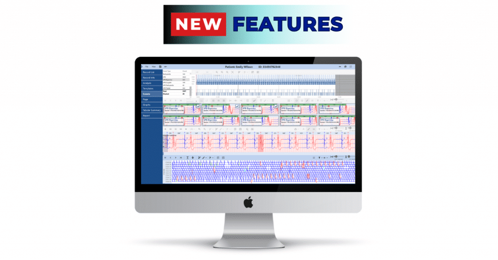New NH-301 Holter Software | Enhanced ECG Analysis