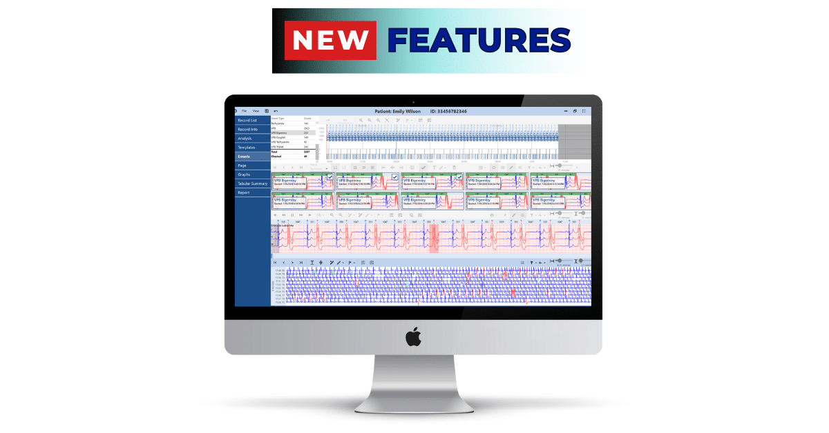 New NH-301 Holter Software | Enhanced ECG Analysis