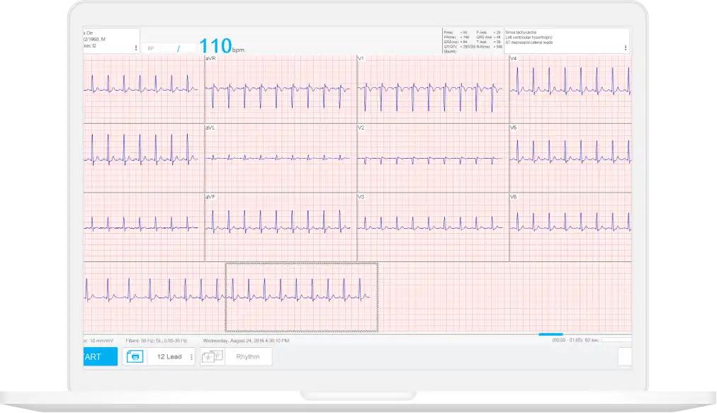 ECG Systems | ECG Excellence over 30 years - Norav Medical