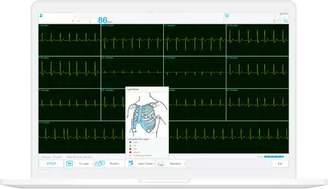 ECG Systems | ECG Excellence over 30 years - Norav Medical