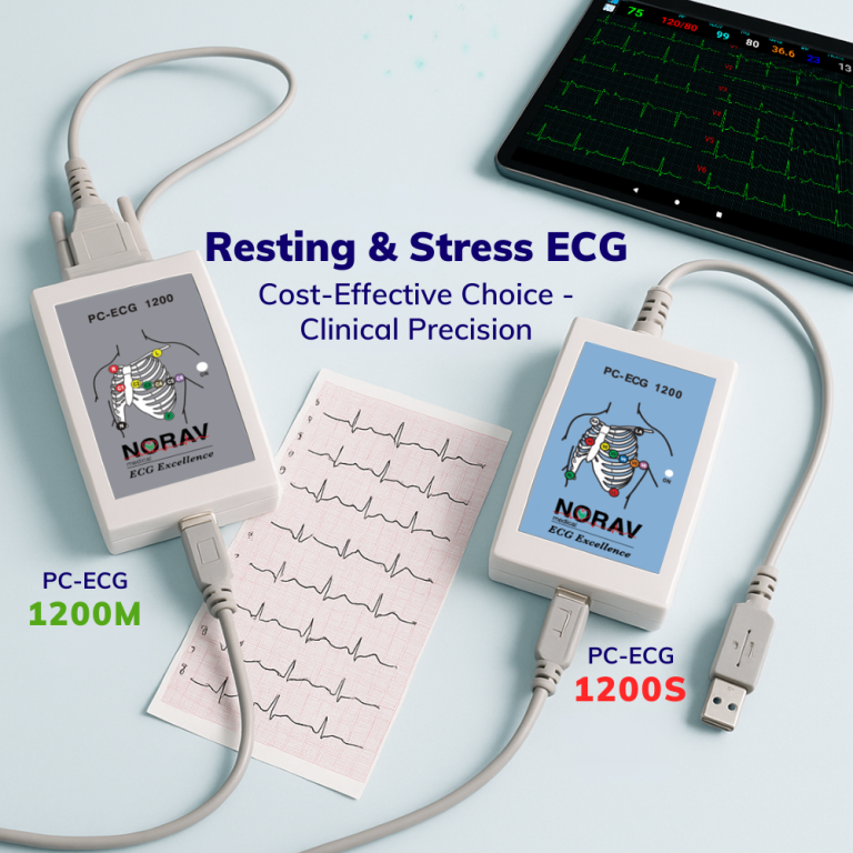 Stress ECG | Stress Test Machine - Norav Medical
